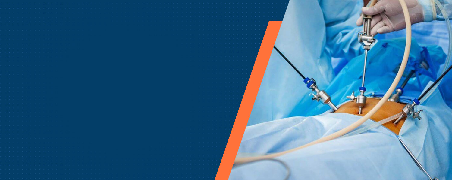 Best Laparoscopic And Vascular Surgeon In Andheri